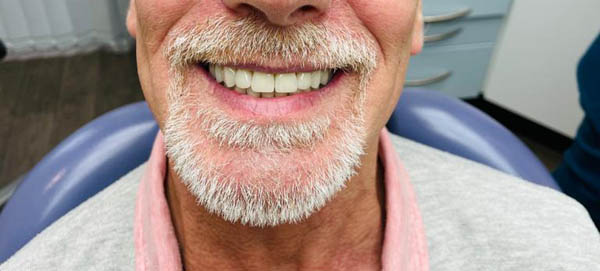 Robert’s Implant Journey | Croft Dental